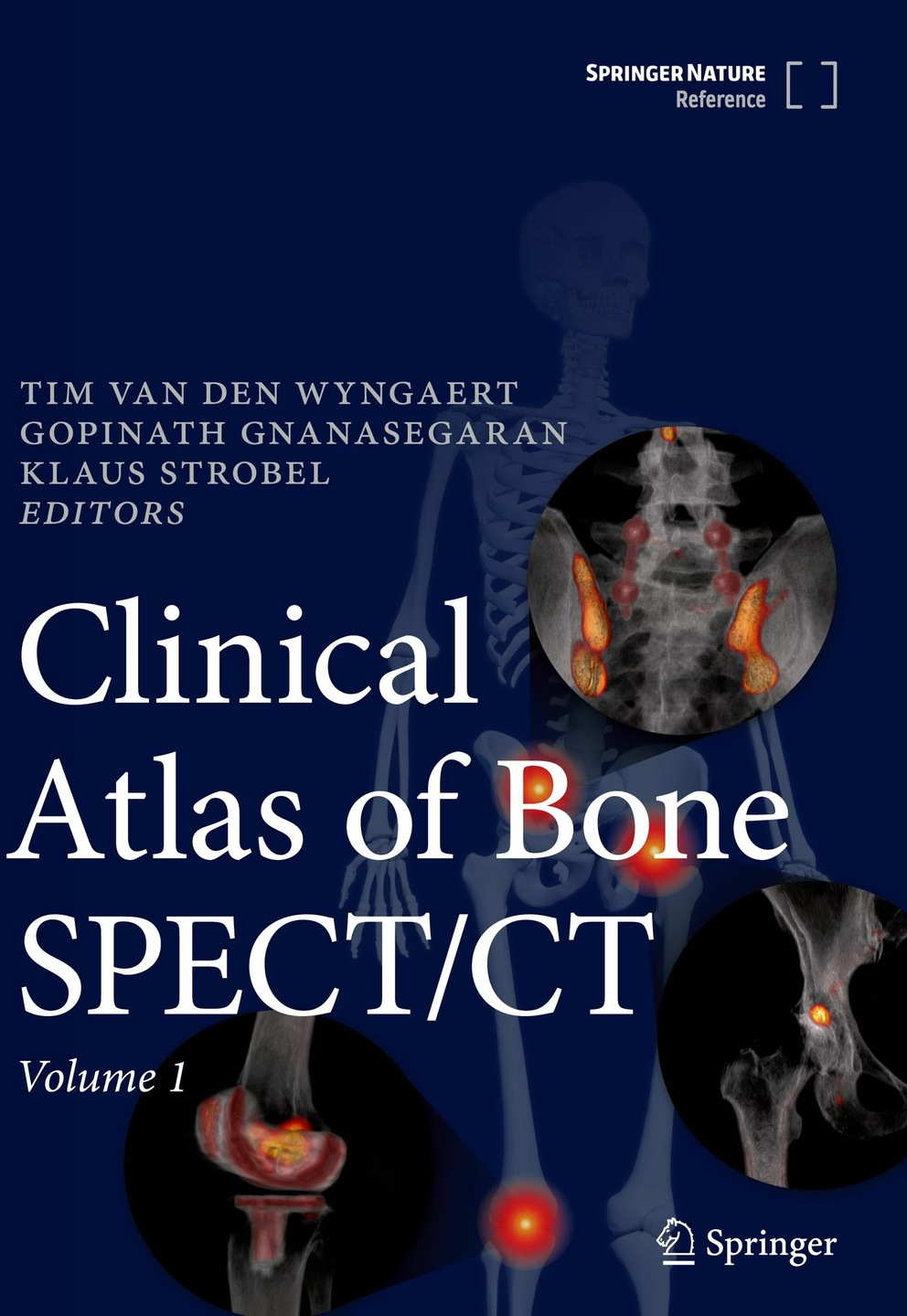 Clinical Atlas of Bone SPECT/CT (English, Klaus Strobel, Tim van den ...