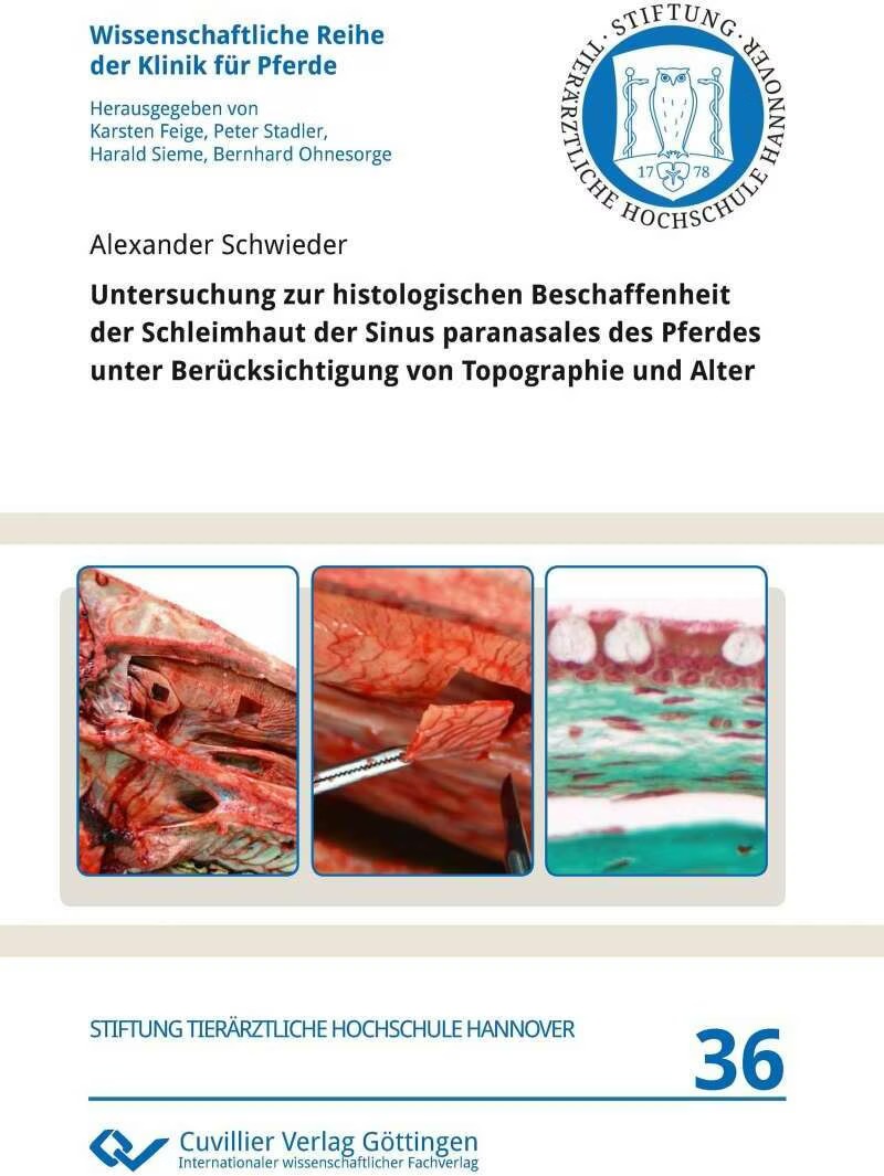 Histological examination of the mucous membrane of the paranasal ...