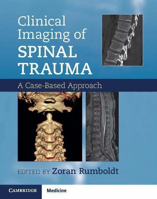 Clinical Imaging of Spinal Trauma (Englisch, Zoran Rumboldt, Alessandro ...